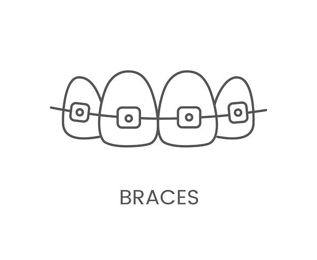 Orthodontic Braces with Sleek Metal Brackets and Wires | Jiffy Designs