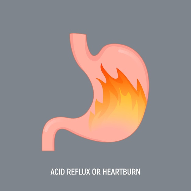 Vibrant Stomach Icon Depicting Acid Reflux or Heartburn | Jiffy Designs