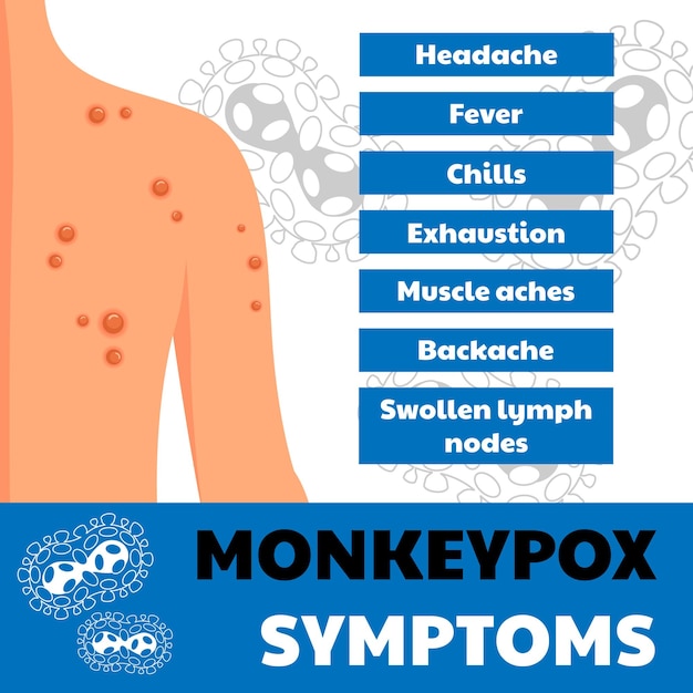 Detailed Monkeypox Symptoms Illustrated in Informative Template | Jiffy ...