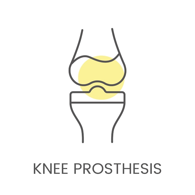 Stylized Diagram of a Knee Prosthetic Joint | Jiffy Designs