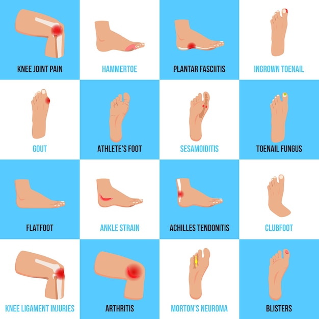 Diverse Foot and Ankle Conditions Illustrated in Detailed Collection ...