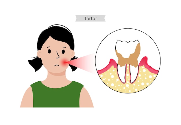 Vibrant Tartar Illustration: A Visual Guide to Dental Health | Jiffy ...