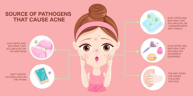 Acne Causes Revealed: A Comprehensive Visual Guide | Jiffy Designs