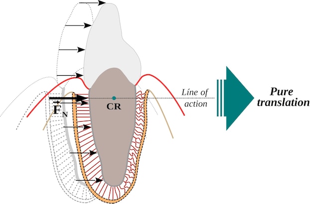 Detailed Diagram Showcasing the Mechanics of Pure Translation | Jiffy ...