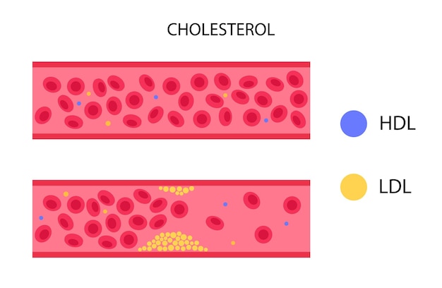 Vibrant Visualization of Cholesterol Levels and HDL/LDL Balance | Jiffy ...