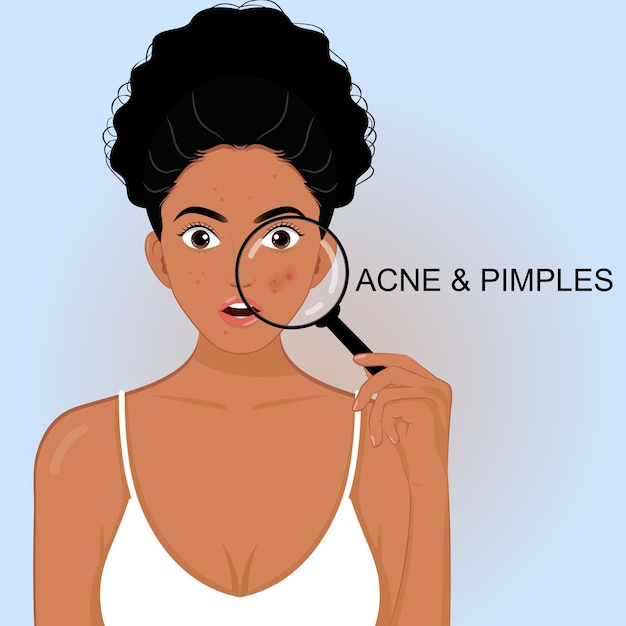 Magnified View of Acne and Pimples on a Woman's Face | Jiffy Designs