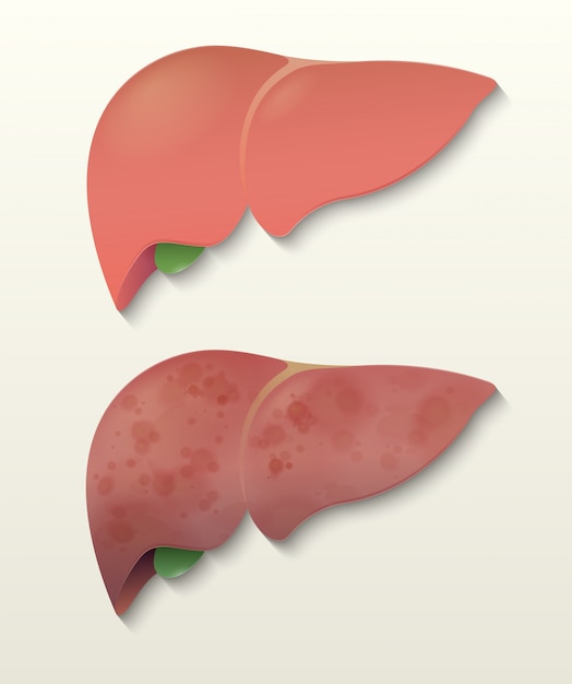 Vibrant Liver Anatomy Illustration for Medical Education | Jiffy Designs
