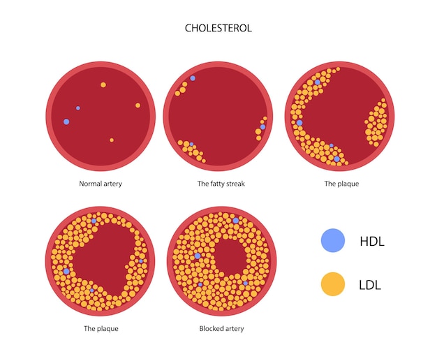 Detailed Cholesterol Levels Depicted in Vibrant Illustrations | Jiffy ...