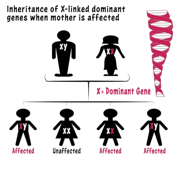 Inheritance of X-linked Dominant Genes When Mother is Affected | Jiffy ...