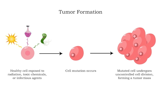 Stages of Tumor Formation: From Healthy Cell to Uncontrolled Growth ...